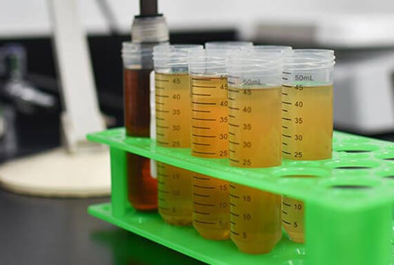 Cell Counting Your Yeast Culture